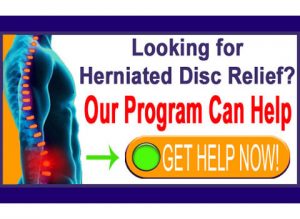 X-Stop for Spinal Stenosis - Spinal Stenosis